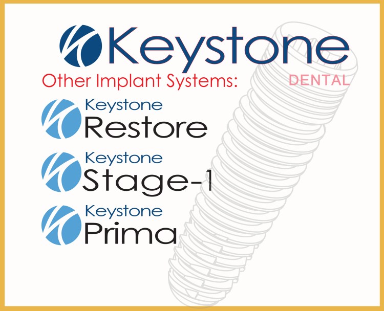 Implant System – Implant Resources Centre (Far East) Limited